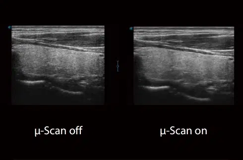 Sonoscape P9 Elite Ultrasound Machine | EIKON MEDICAL SOLUTIONS SDN BHD