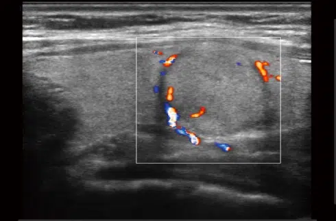 Sonoscape P9 Elite Ultrasound Machine | EIKON MEDICAL SOLUTIONS SDN BHD