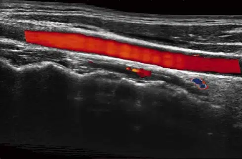 Sonoscape P9 Elite Ultrasound Machine | EIKON MEDICAL SOLUTIONS SDN BHD