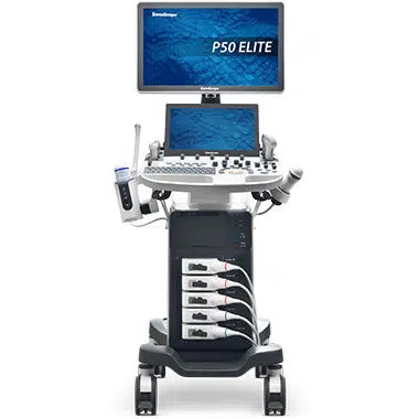 Sonoscape P50 Elite Premium Ultrasound Machine | EIKON MEDICAL SOLUTIONS SDN BHD