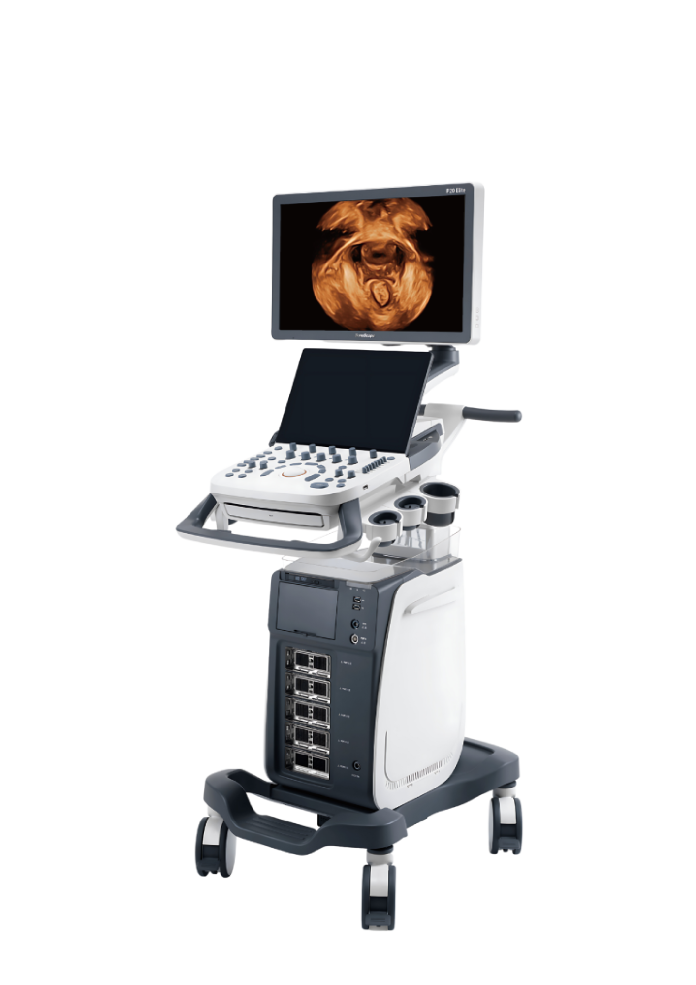 Sonoscape P20 Elite Ultrasound Machine | EIKON MEDICAL SOLUTIONS SDN BHD