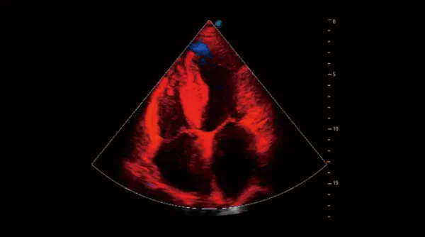 Sonoscape P50 Elite Premium Ultrasound Machine | EIKON MEDICAL ...