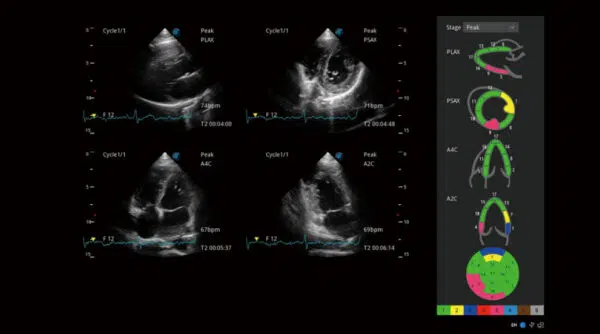 Sonoscape P50 Elite Premium Ultrasound Machine | EIKON MEDICAL ...