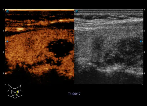 Sonoscape P60 Premium Ultrasound Machine | EIKON MEDICAL SOLUTIONS SDN BHD