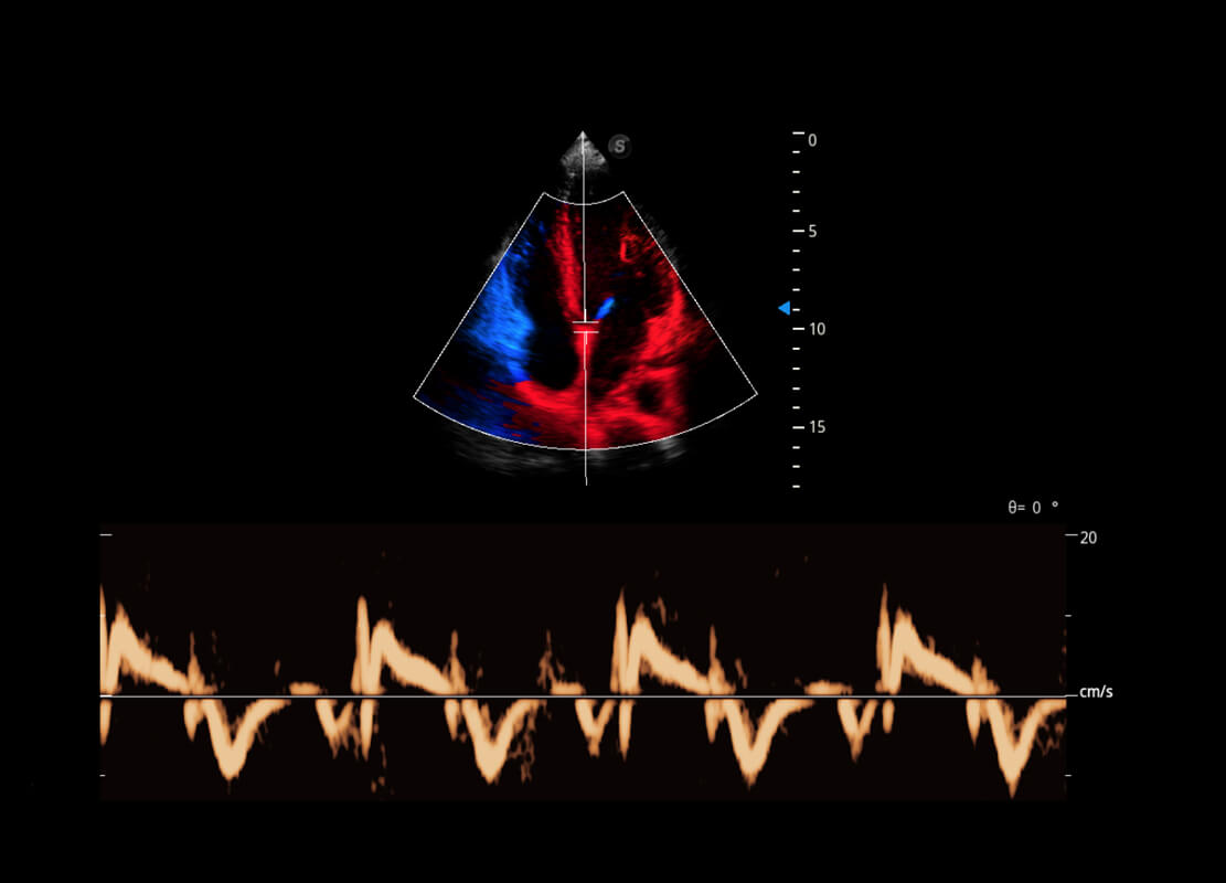Sonoscape P60 Premium Ultrasound Machine | EIKON MEDICAL SOLUTIONS SDN BHD