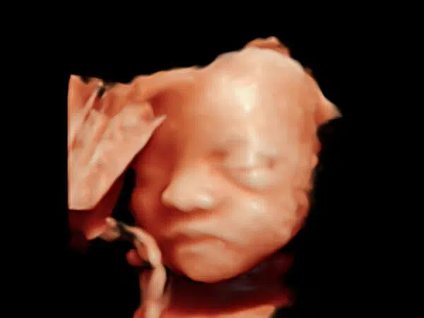 Sonoscape P60 Premium Ultrasound Machine | EIKON MEDICAL SOLUTIONS SDN BHD