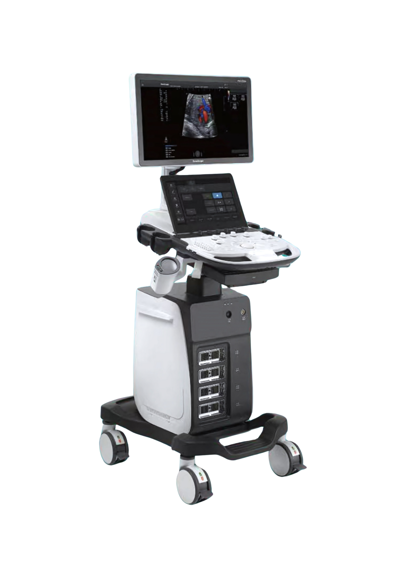 Sonoscape P11 Elite Ultrasound Machine | EIKON MEDICAL SOLUTIONS SDN BHD