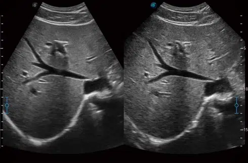 Sonoscape P9 Elite Ultrasound Machine | EIKON MEDICAL SOLUTIONS SDN BHD