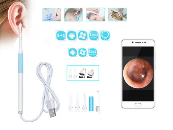 China Digital USB Ear Scope (Ear Clean Tool) | EIKON MEDICAL SOLUTIONS ...