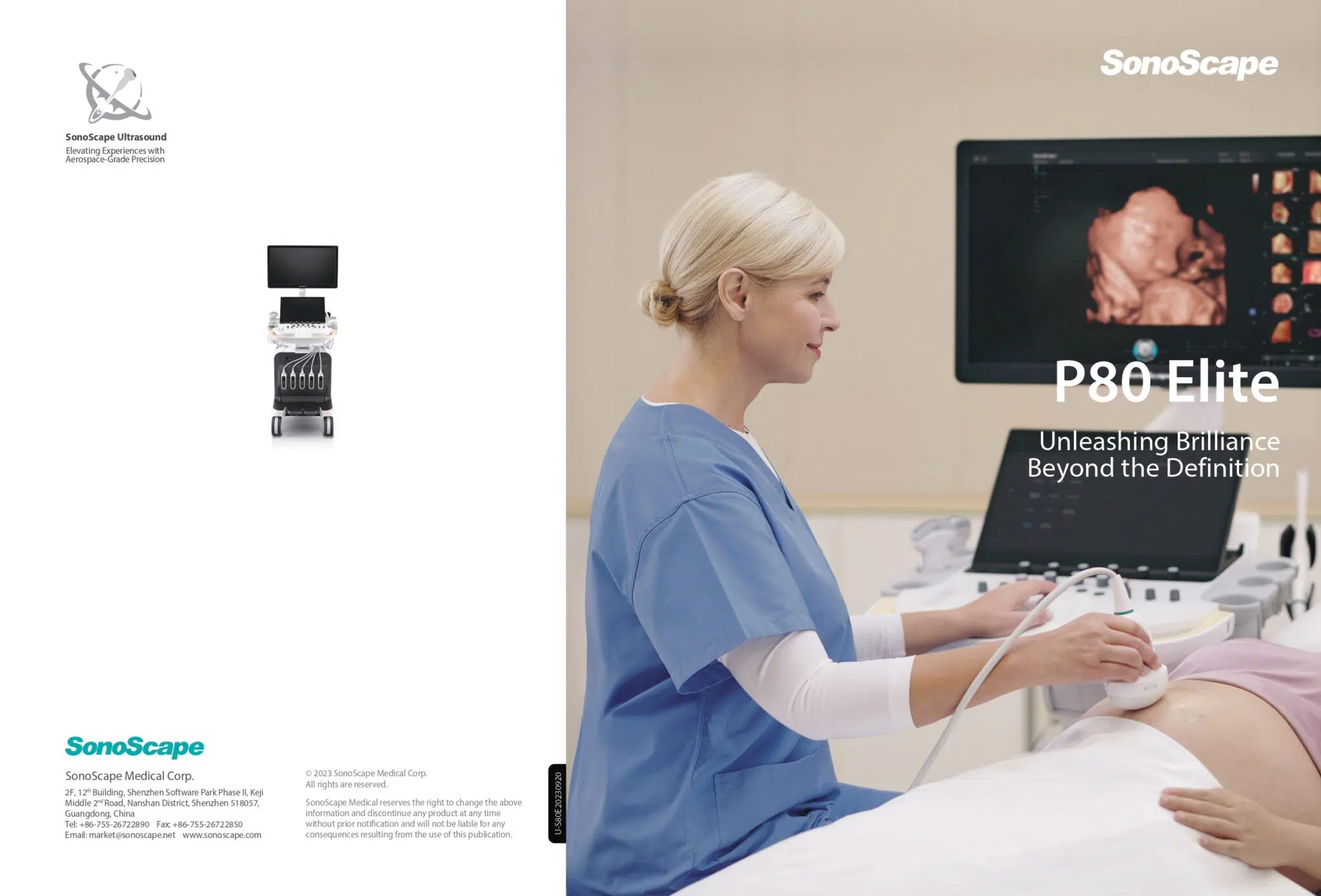 Discover the Sonoscape P80 Elite: Advanced Ultrasound Technology