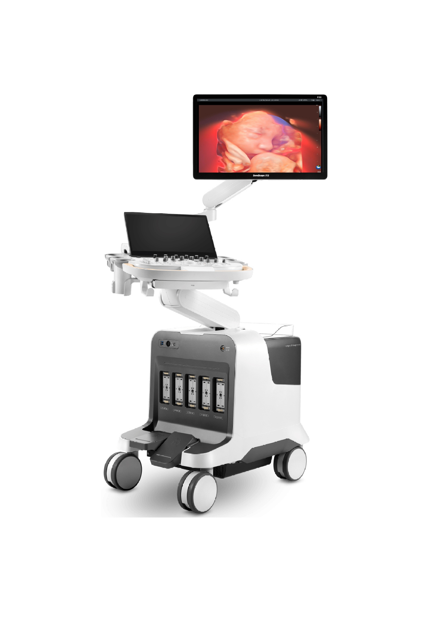 Discover the Sonoscape P80 Elite: Advanced Ultrasound Technology
