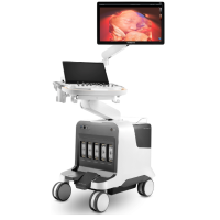 Ultrasound Machine | Medical Device Supplier Malaysia
